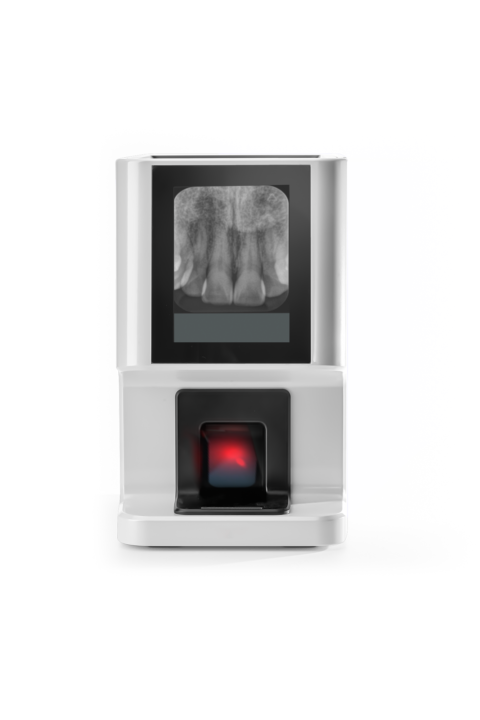 PHX Scanner Fosfori - Atom Workflow