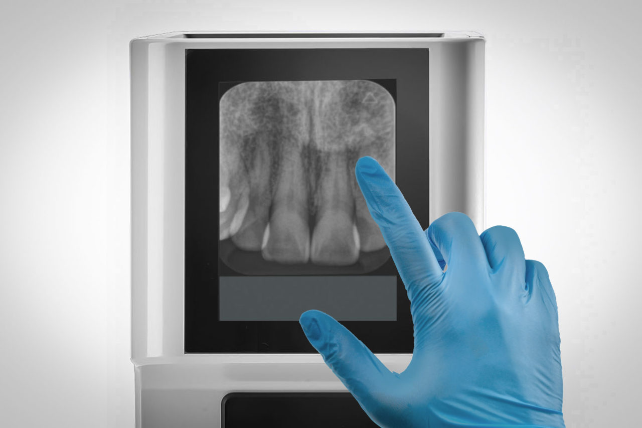 PHX Scanner Fosfori - Atom Workflow